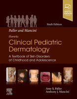 Endocrine disorders and the skin - Clinical Tree